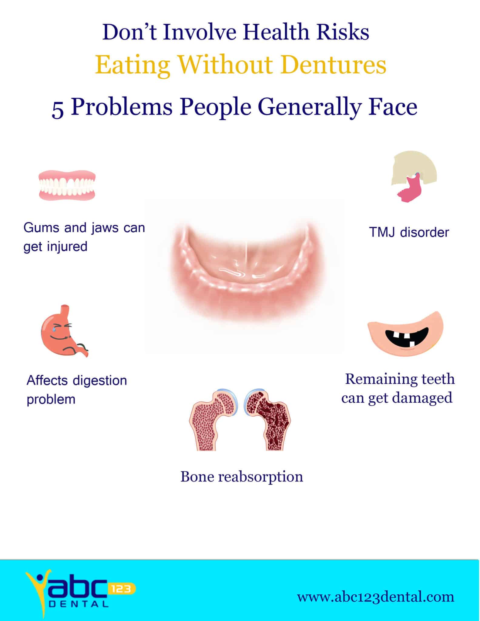 Don’t Involve Health Risks Eating Without Dentures - ABC123 Dental