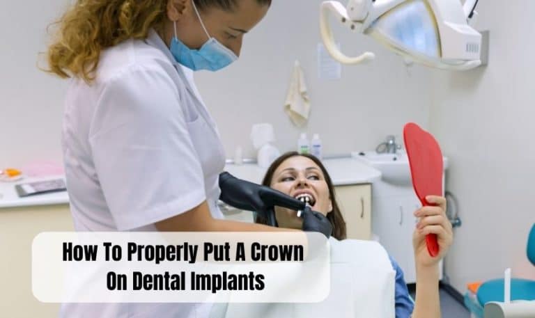How To Properly Put A Crown On Dental Implants